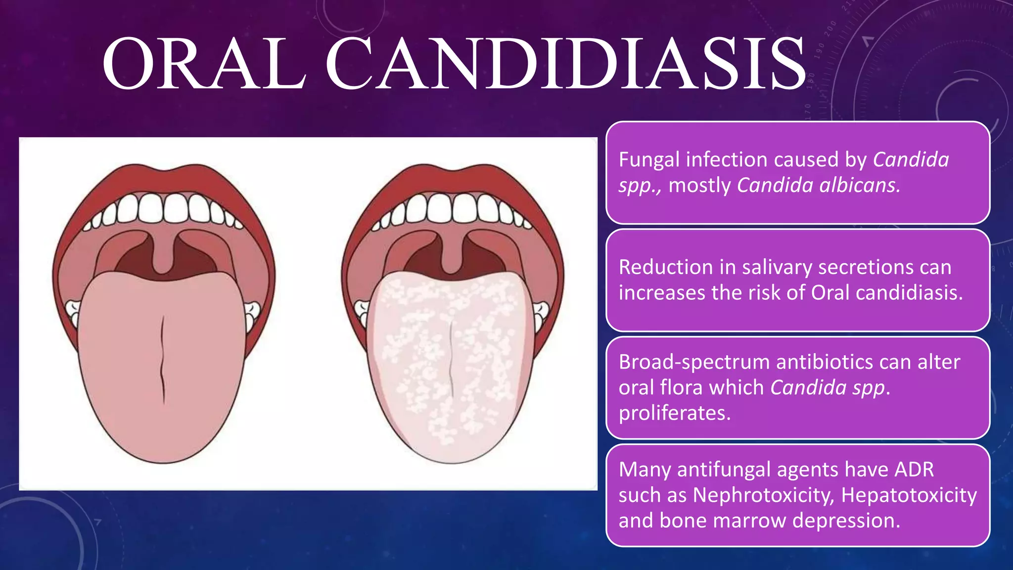 Oral spray, Wafers and fast Dissolving.pptx