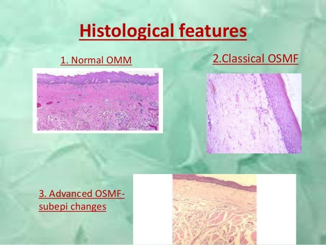NON ODONTOGENIC TUMORS OF ORAL CAVITY-I