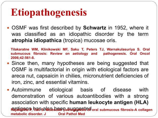Journal club on Oral submucous fibrosis | PPTX