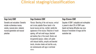 Oral submucous fibrosis basics seminar ppt | PPTX