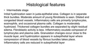 Oral submucous fibrosis basics seminar ppt | PPTX