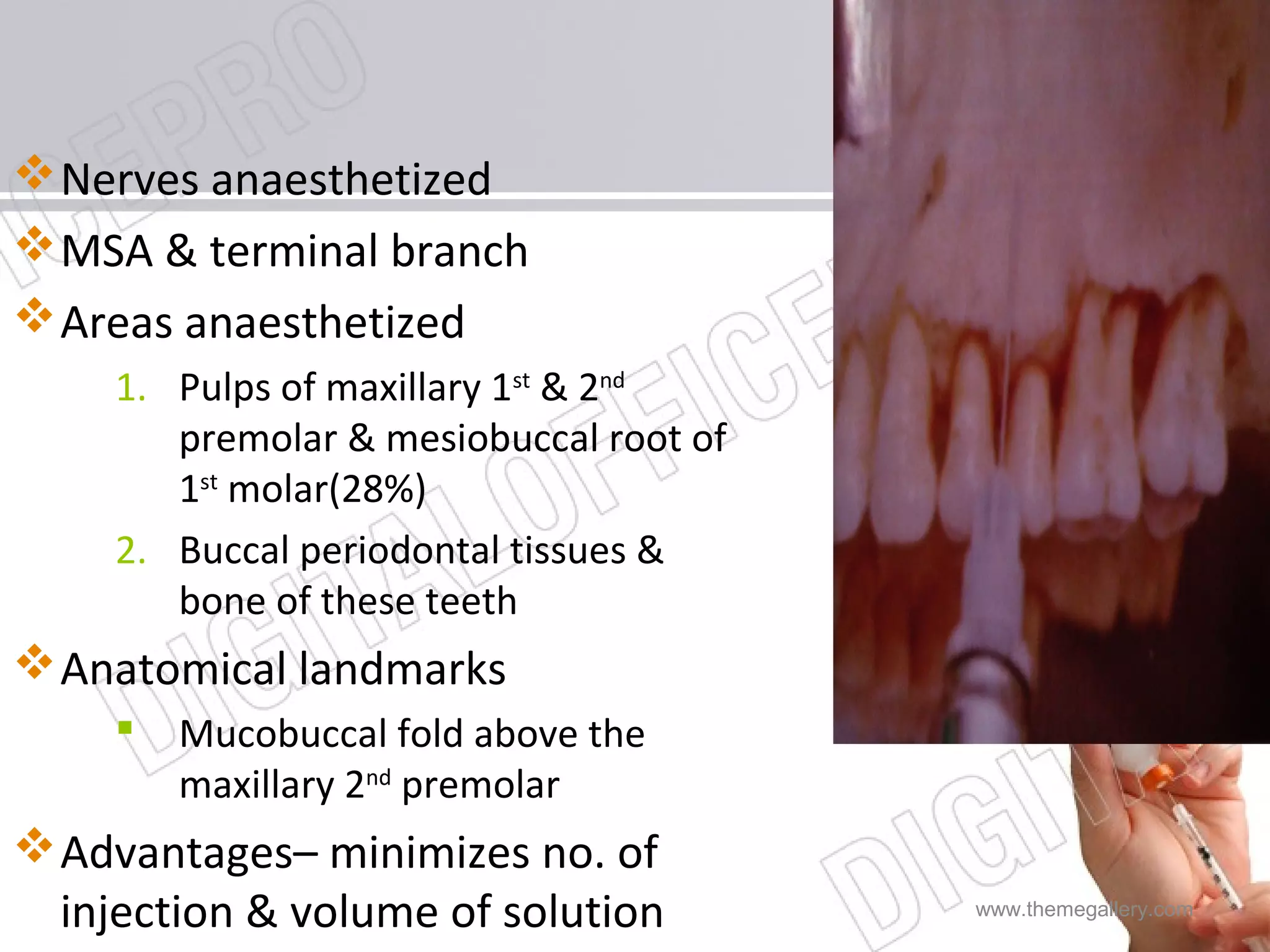 maxillary nerve blocks | PPT