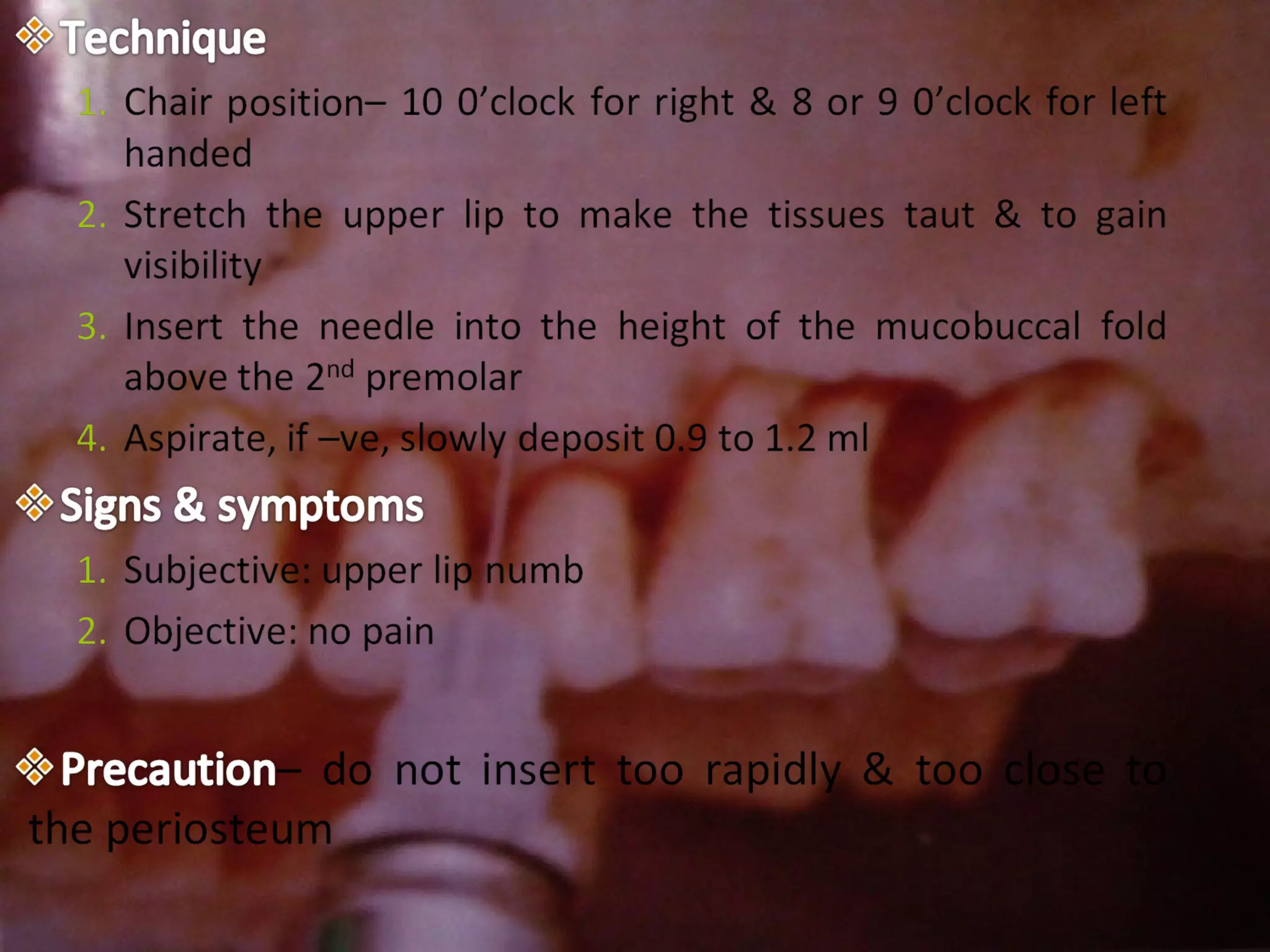 maxillary nerve blocks | PPT