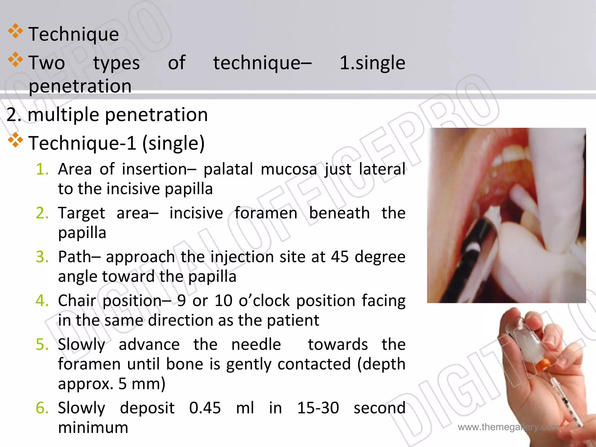 maxillary nerve blocks | PPT