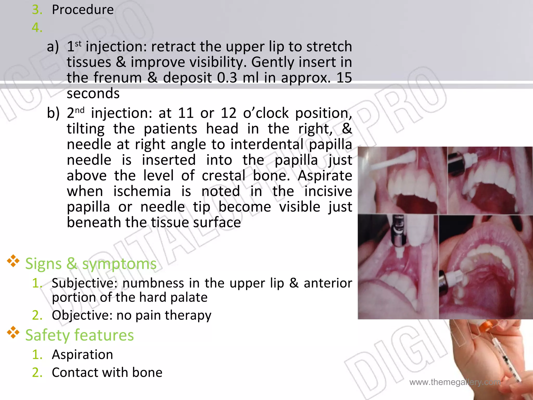maxillary nerve blocks | PPT
