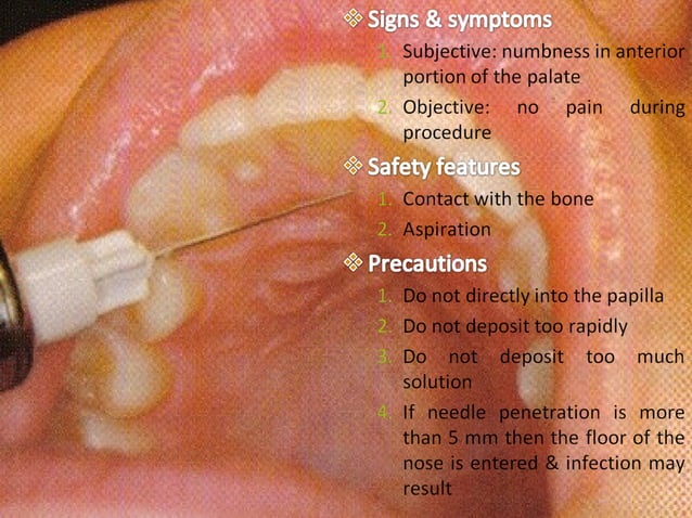 maxillary nerve blocks | PPT
