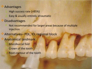 Maxillary Nerve Block High Tuberosity Approach