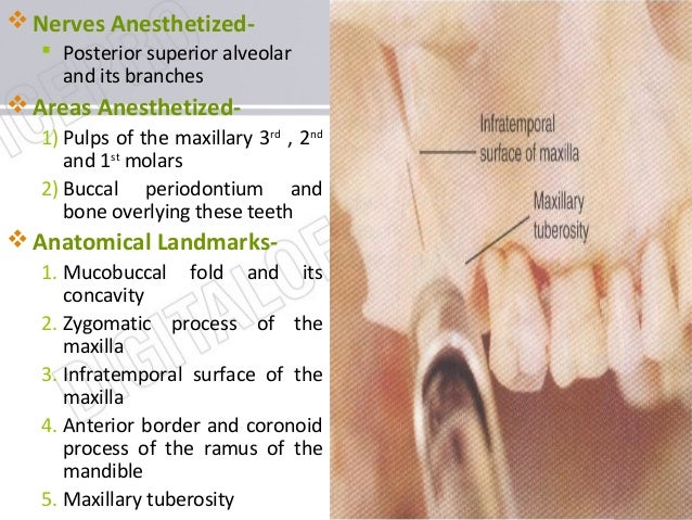 Nerve Root Blocks Procedures For Patients Radiology Demonstration of ...