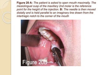 Oral surgery | PPTX