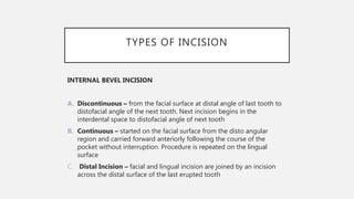 Gingivectomy (oral surgery) | PPTX
