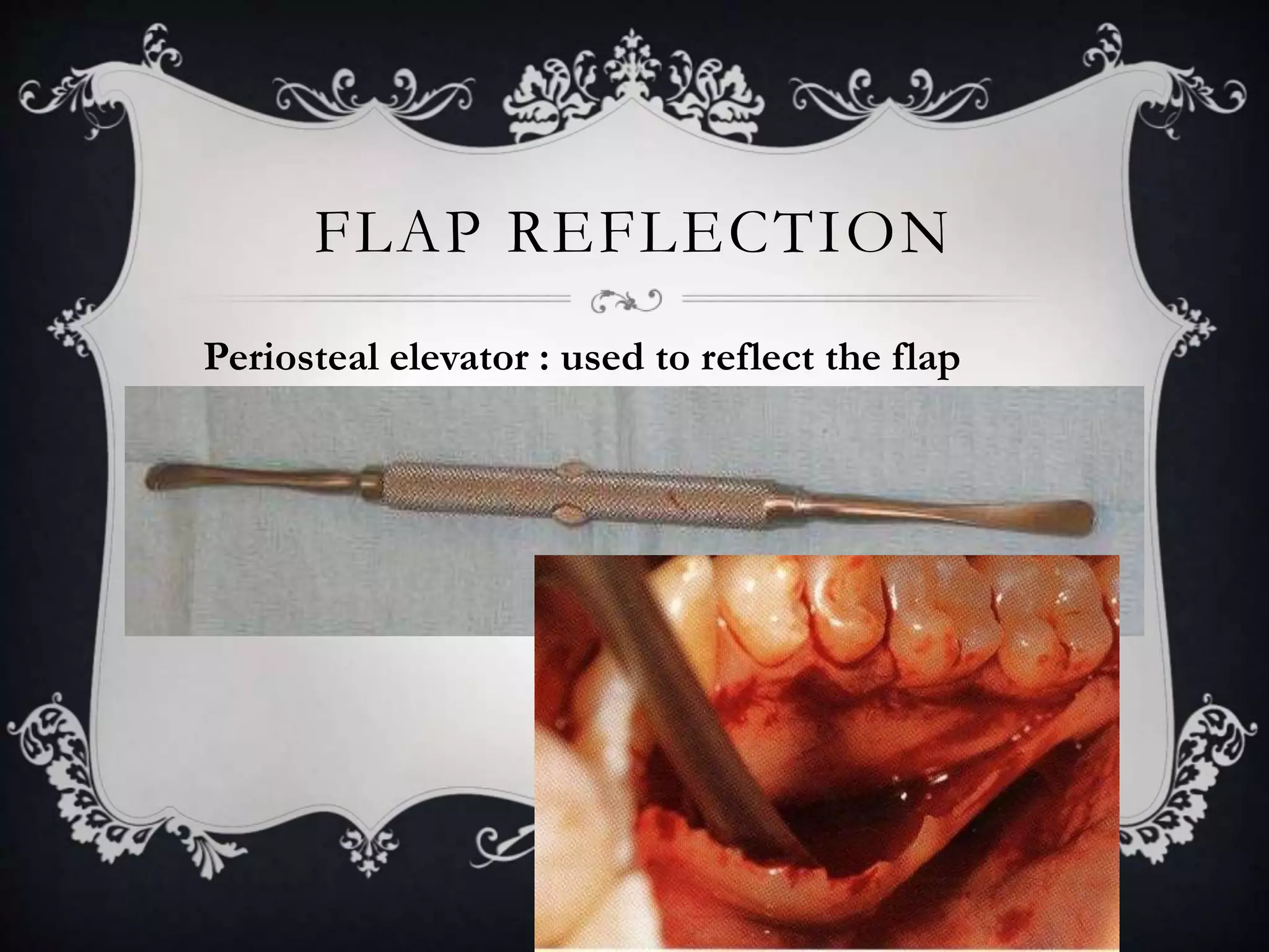 Oral surgery principles | PPTX