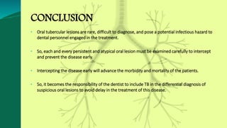 Oral tuberculosis | PPTX