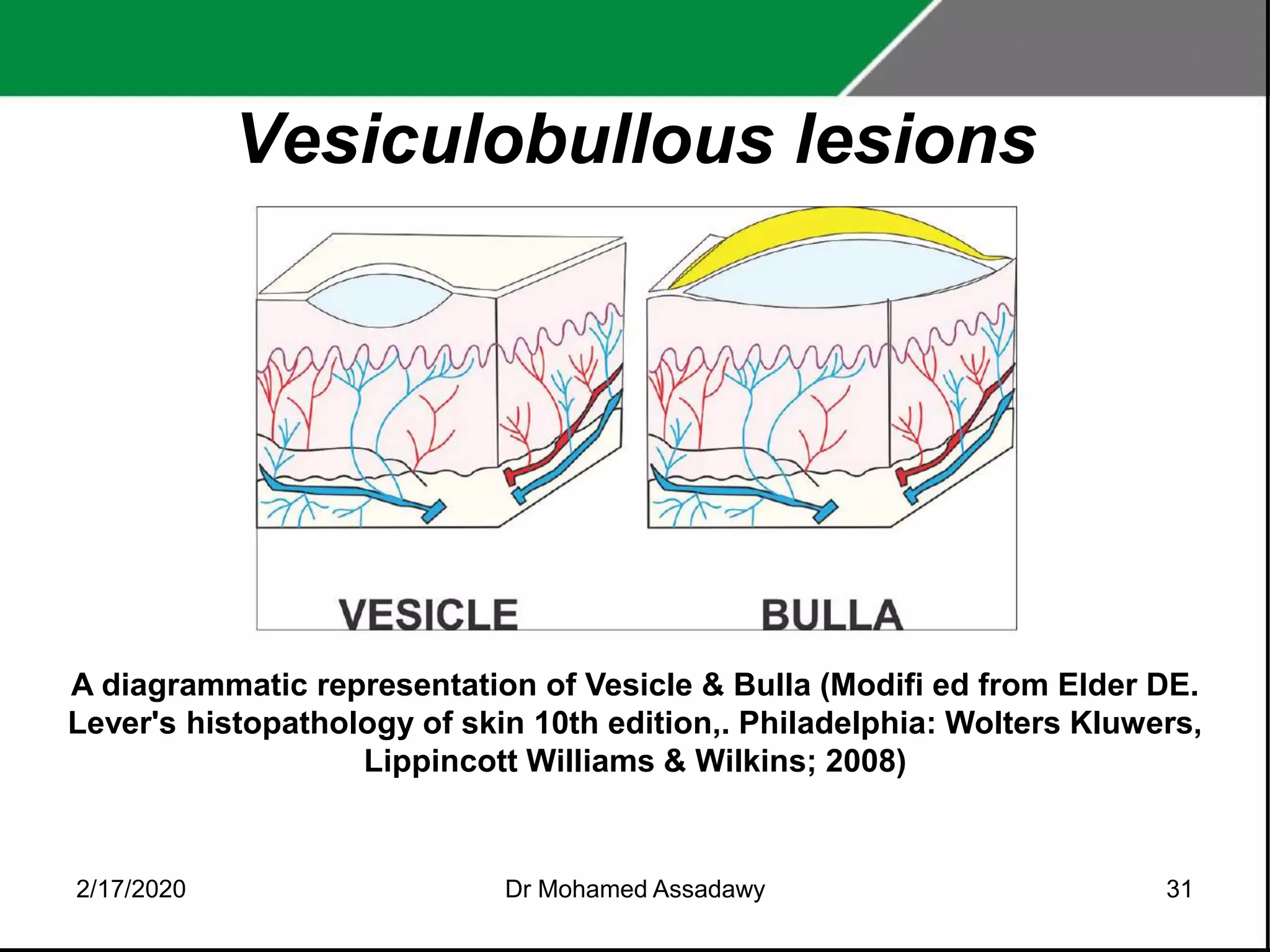Oral ulceration Dr mohamed assadawy | PPTX