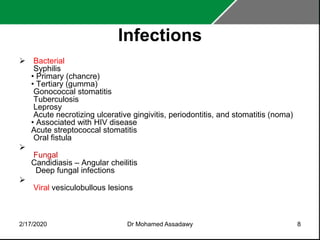 Oral ulceration Dr mohamed assadawy | PPTX