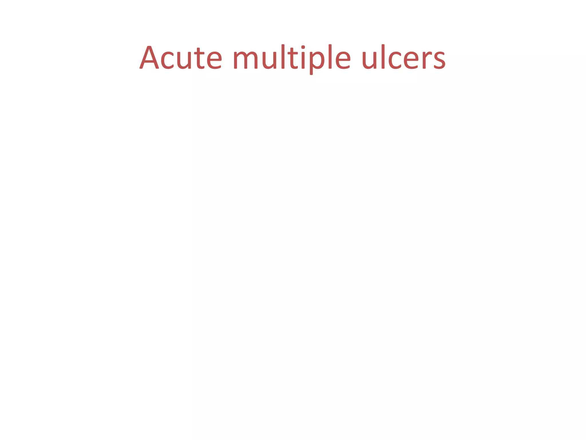 Oral ulcers | PPT