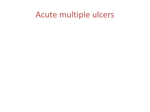 Oral ulcers | PPT | Infectious Diseases | Diseases and Conditions