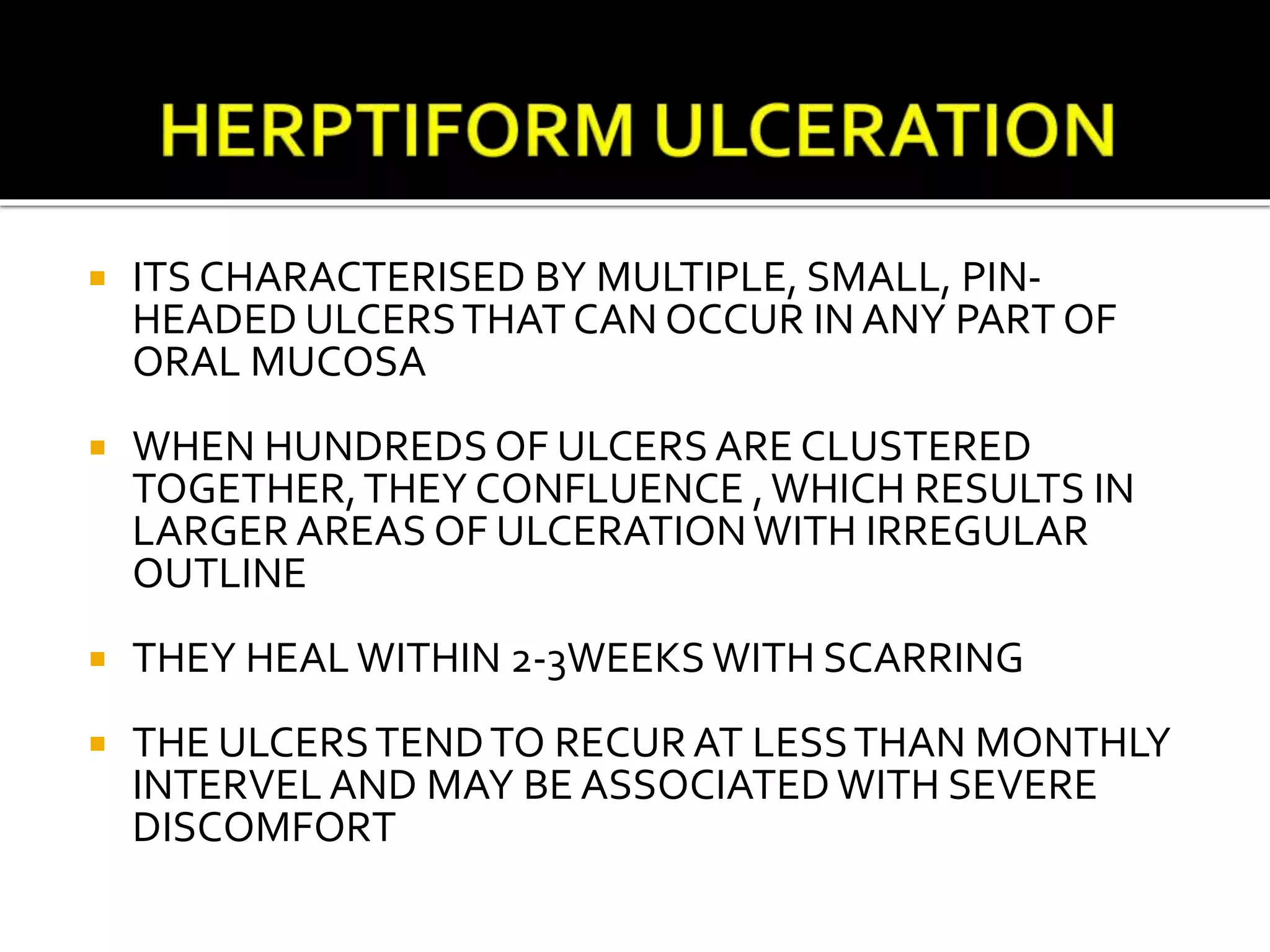 Oral ulcers | PPTX