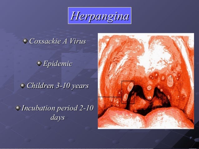 Oral ulcers(collection)