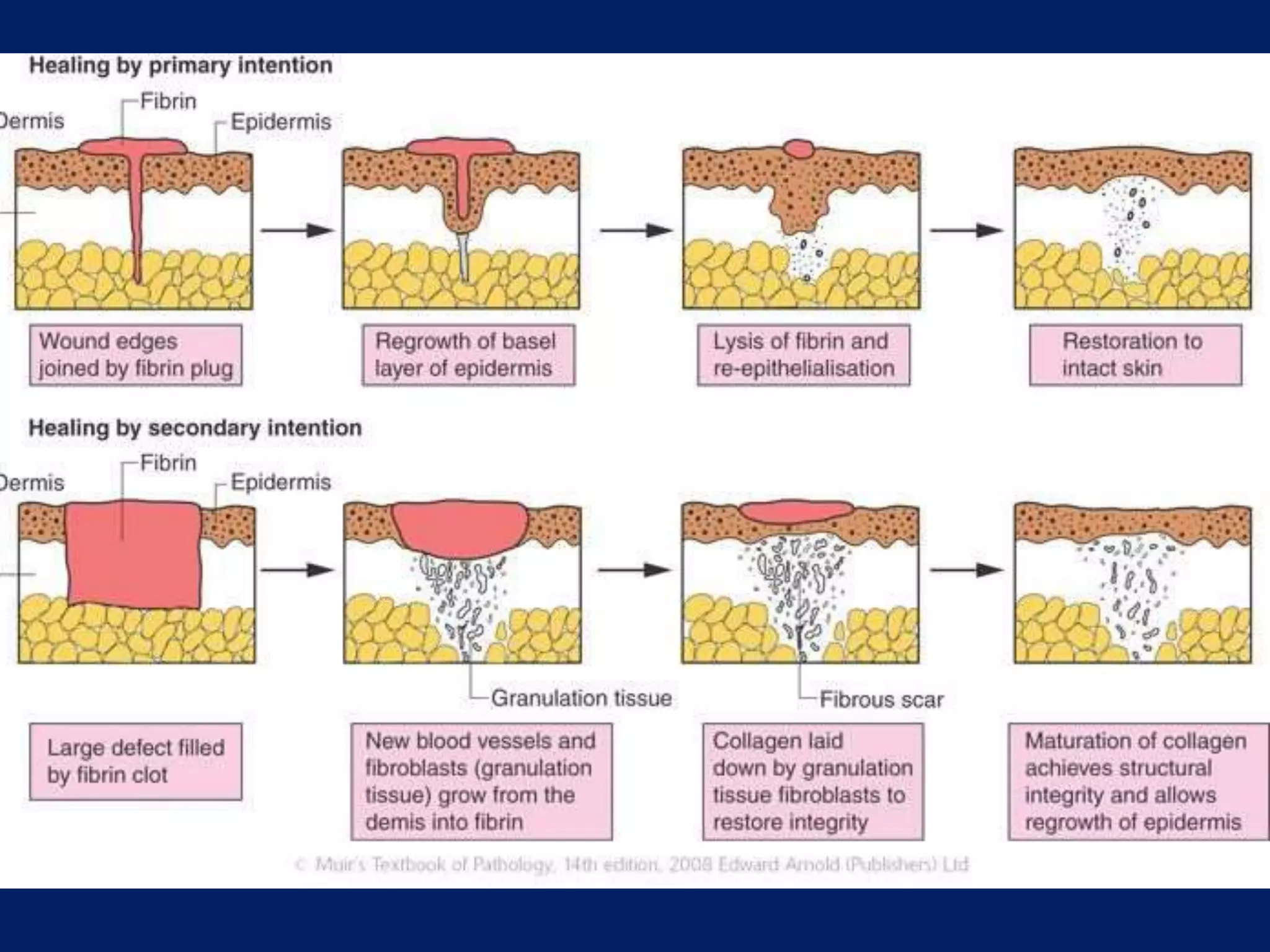 healing of oral wounds | PPTX
