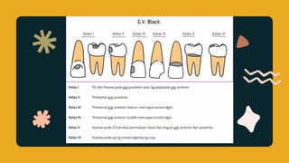 Laporan kasus restorasi kelas 2 komposit.pdf