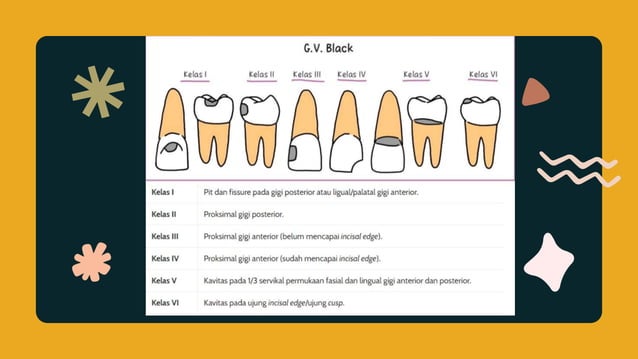 Laporan kasus restorasi kelas 2 komposit.pdf