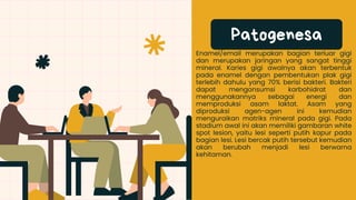 Laporan kasus restorasi kelas 2 komposit.pdf