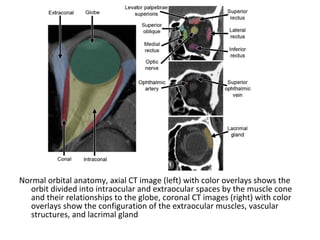 Diagnostic Imaging of Orbital Lesions | PPT