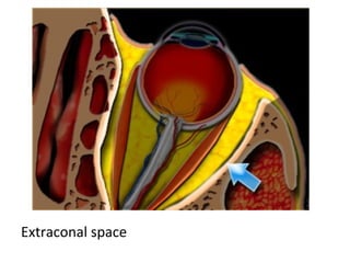 Diagnostic Imaging of Orbital Lesions | PPT