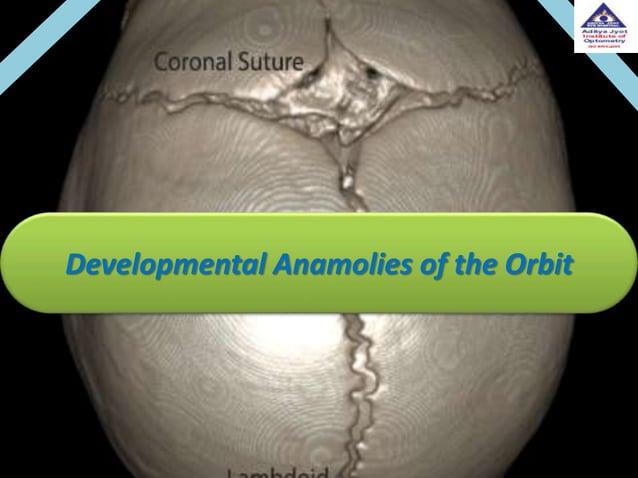 Disease Of Orbit | PPTX | Ear, Nose and Throat Conditions | Diseases ...