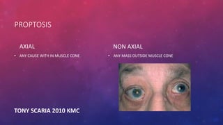 Orbit OPHTHALMOLOGY REVISION NOTES | PPTX