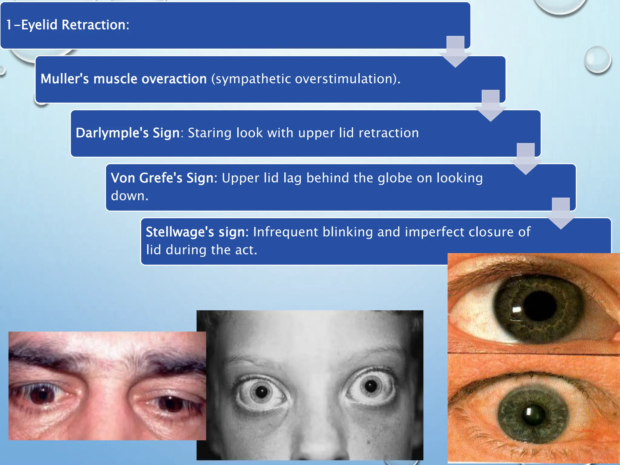 Orbit (anatomy and diseases) for medical students | PPTX