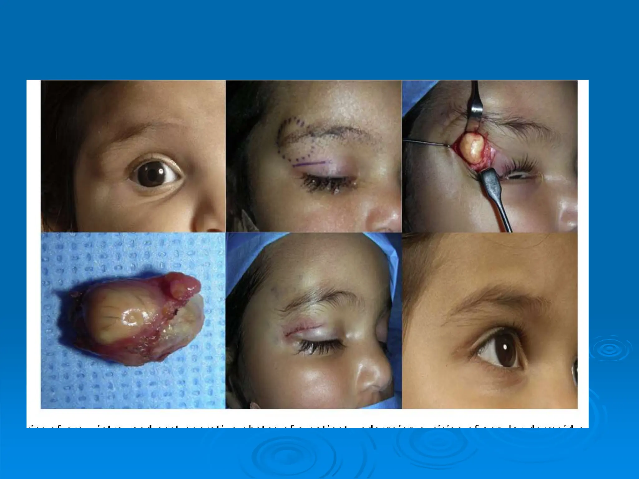 Orbit (anatomy and diseases) for medical students | PPTX