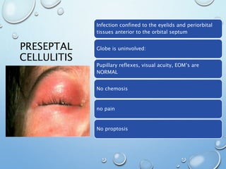 Orbit (anatomy and diseases) for medical students | PPTX