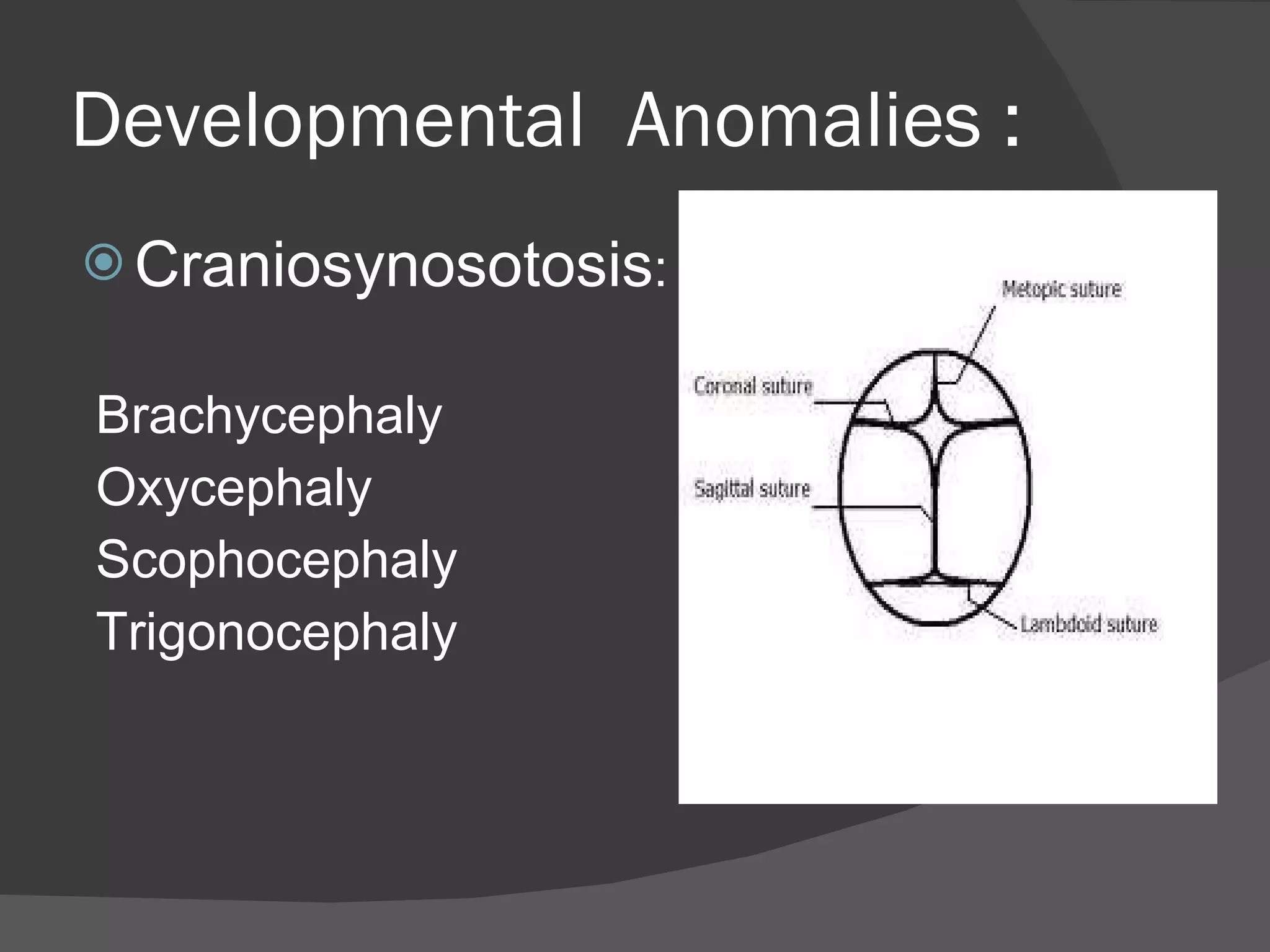 Orbit anatomy | PPT