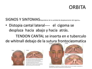 Orbita anatomia fracturas tratamiento qx | PPTX