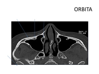 Orbita anatomia fracturas tratamiento qx | PPTX