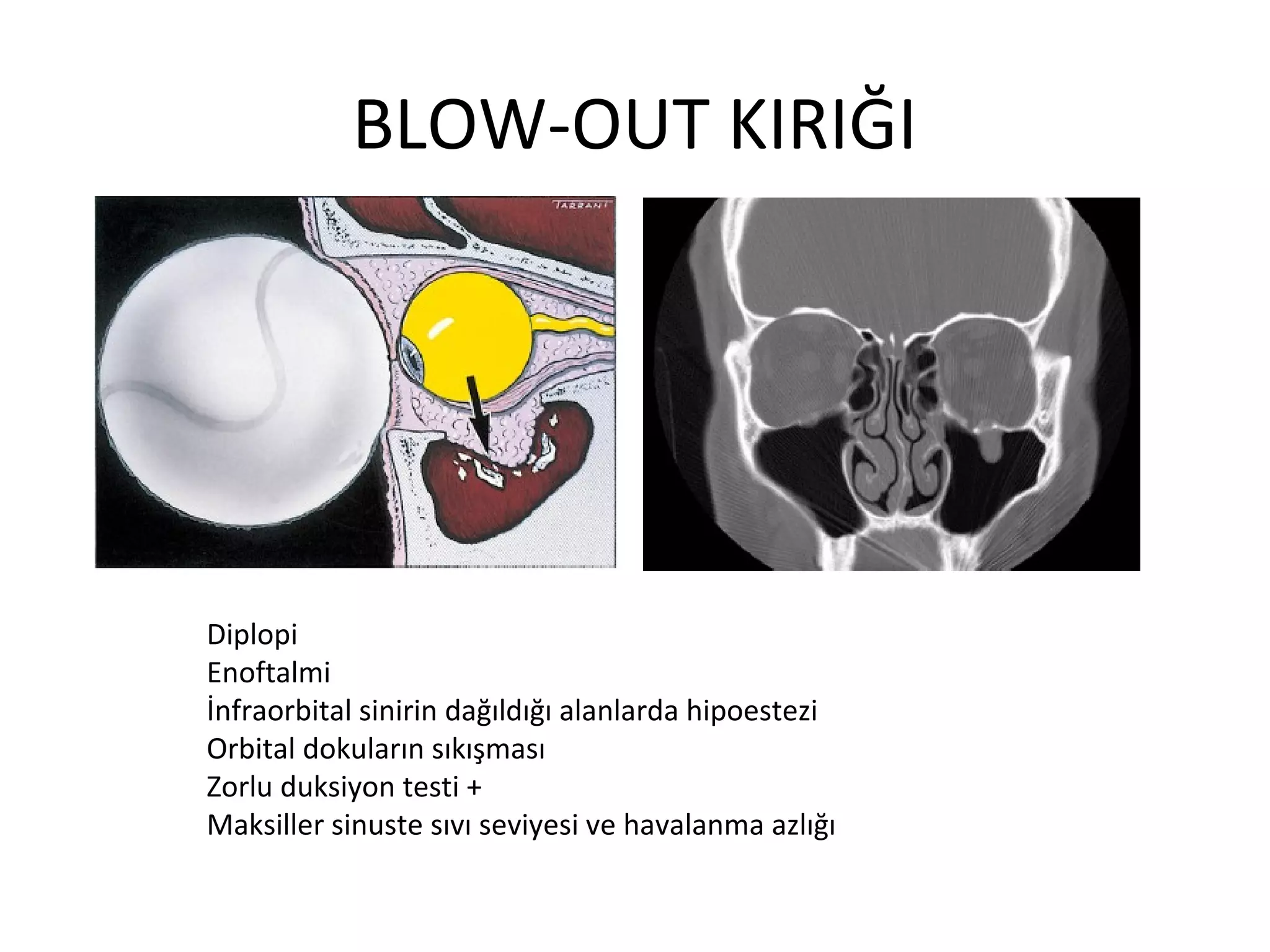 Orbita anatomisi | PPT
