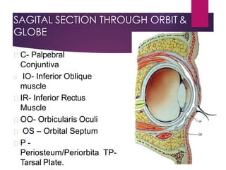 Orbital Fracture & Management | PDF