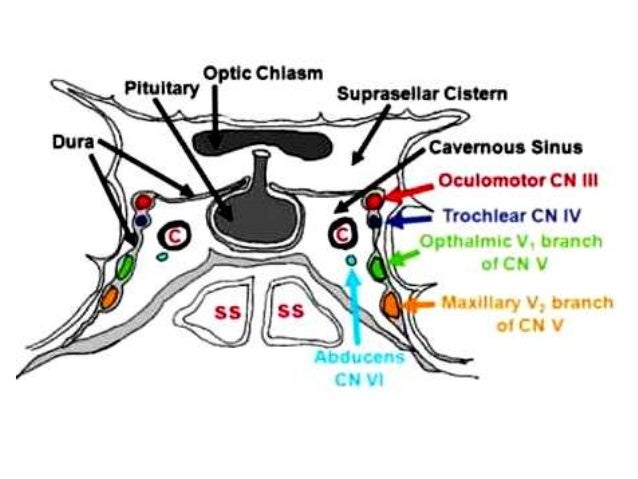 Orbital apex syndrome