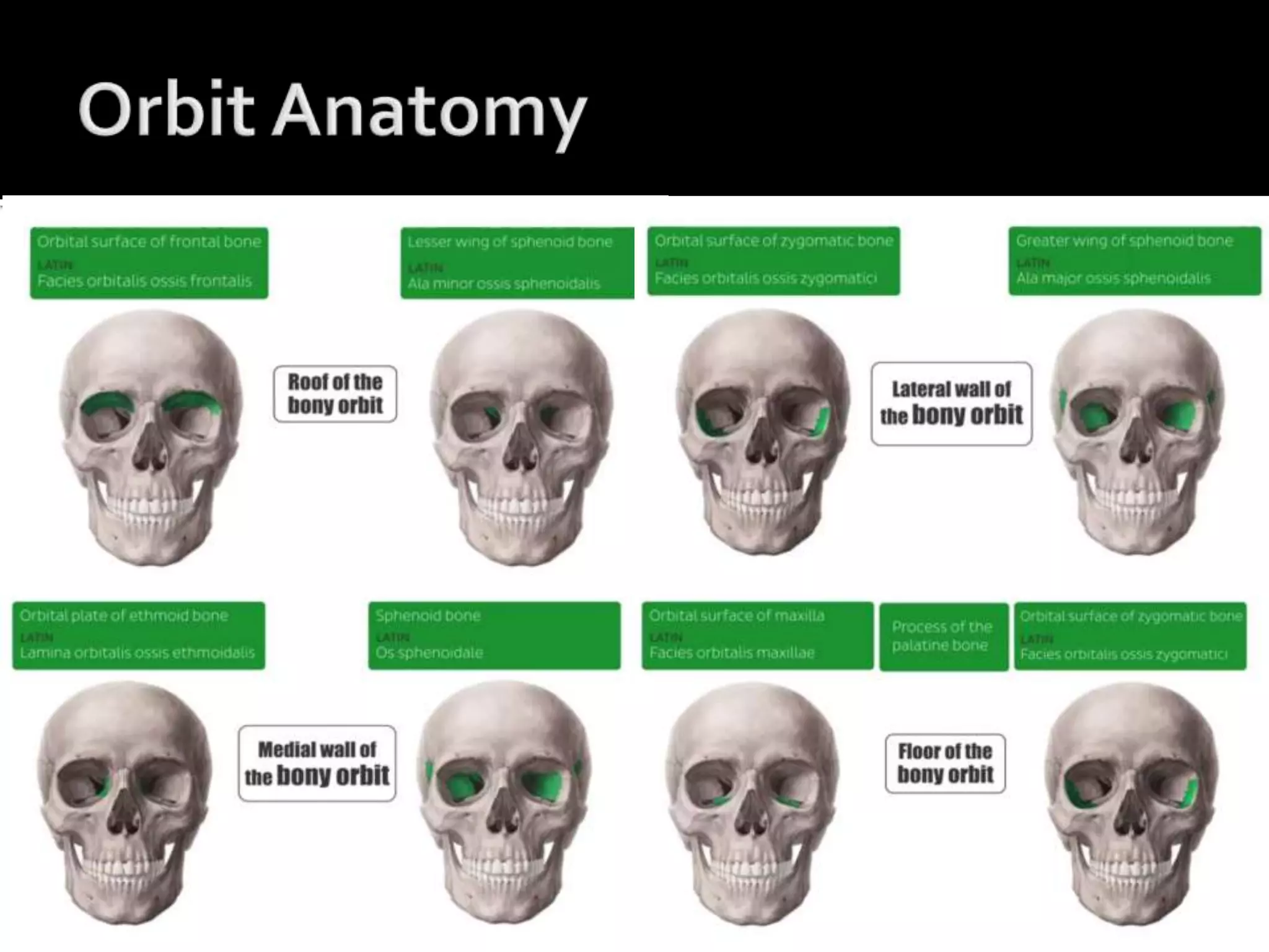 Orbital Apex Syndrome | PPTX