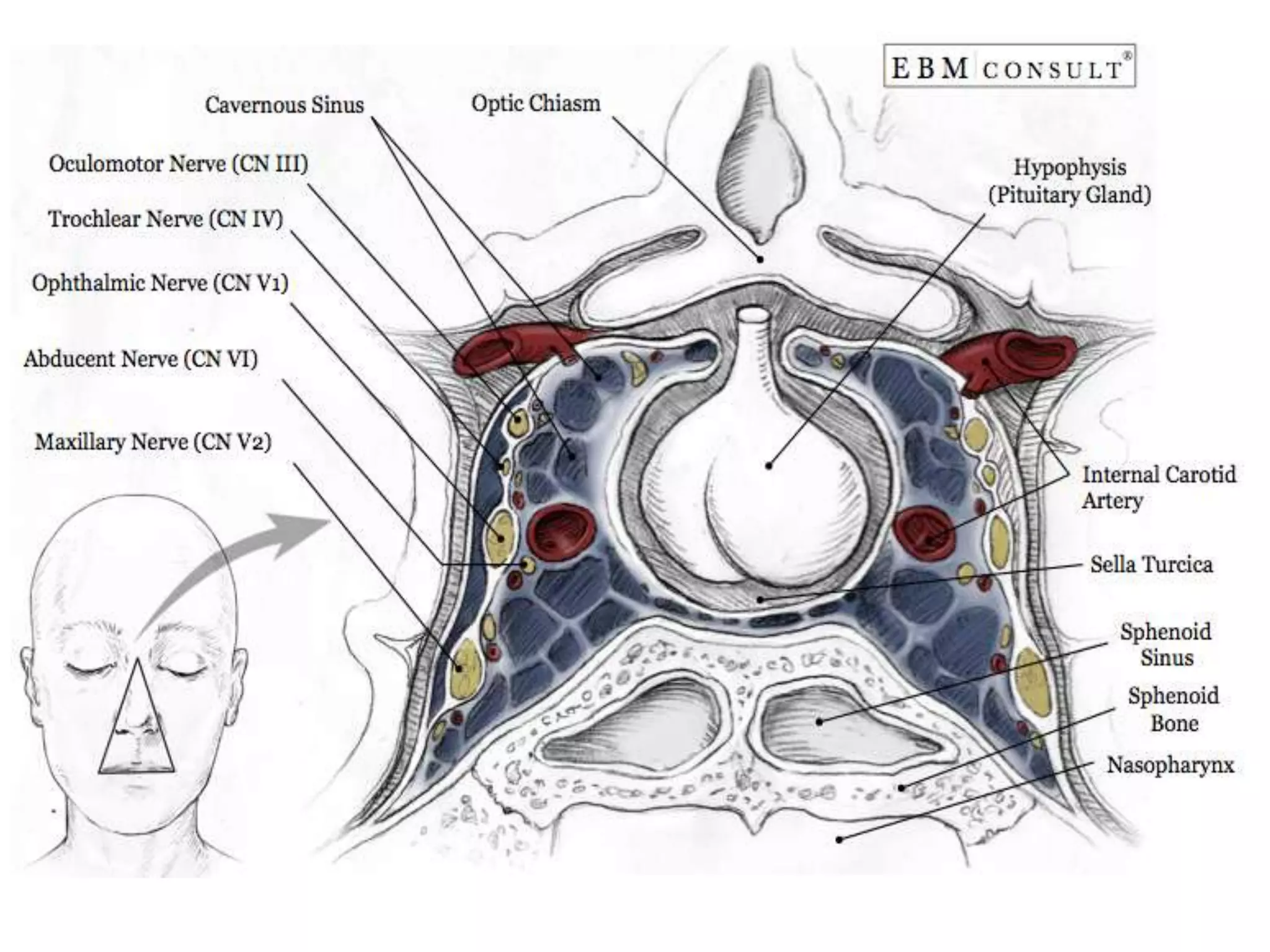 Orbital Apex Syndrome | PPTX