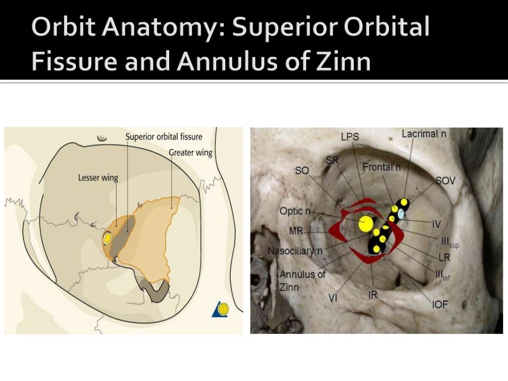 Orbital Apex Syndrome
