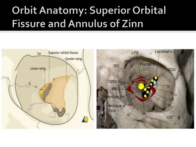 Orbital Apex Syndrome