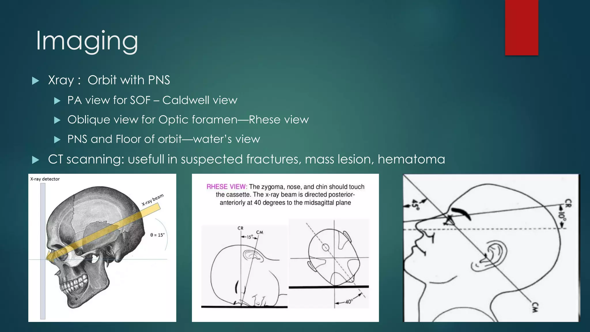 Orbital apex syndrome | PDF