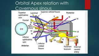Orbital apex syndrome | PDF | Ear, Nose and Throat Conditions ...