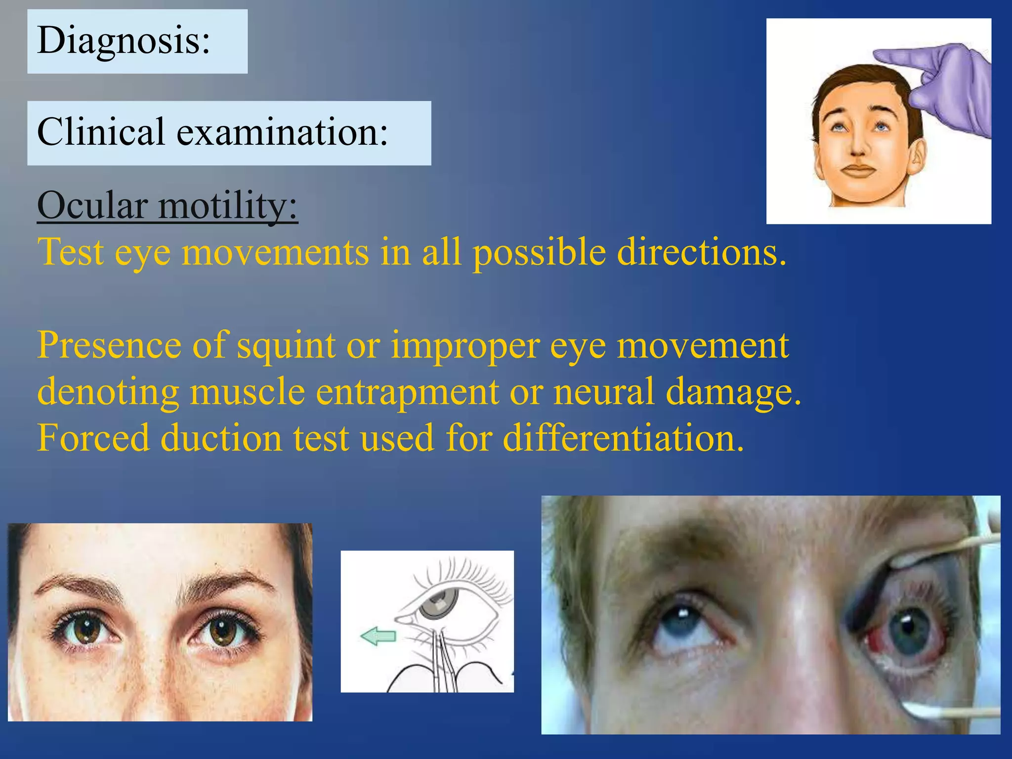 Orbital Blowout Fracture Ppt