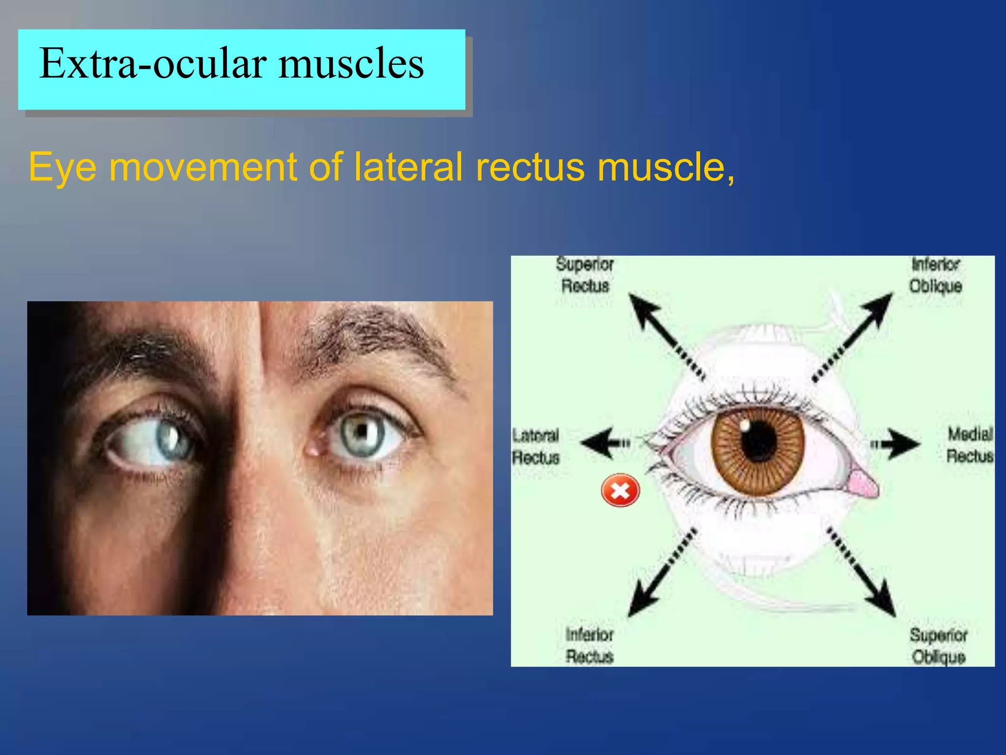 Orbital Blowout Fracture Ppt
