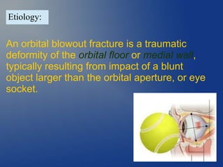 Orbital blowout fracture | PPT