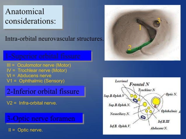 Orbital blowout fracture | PPT