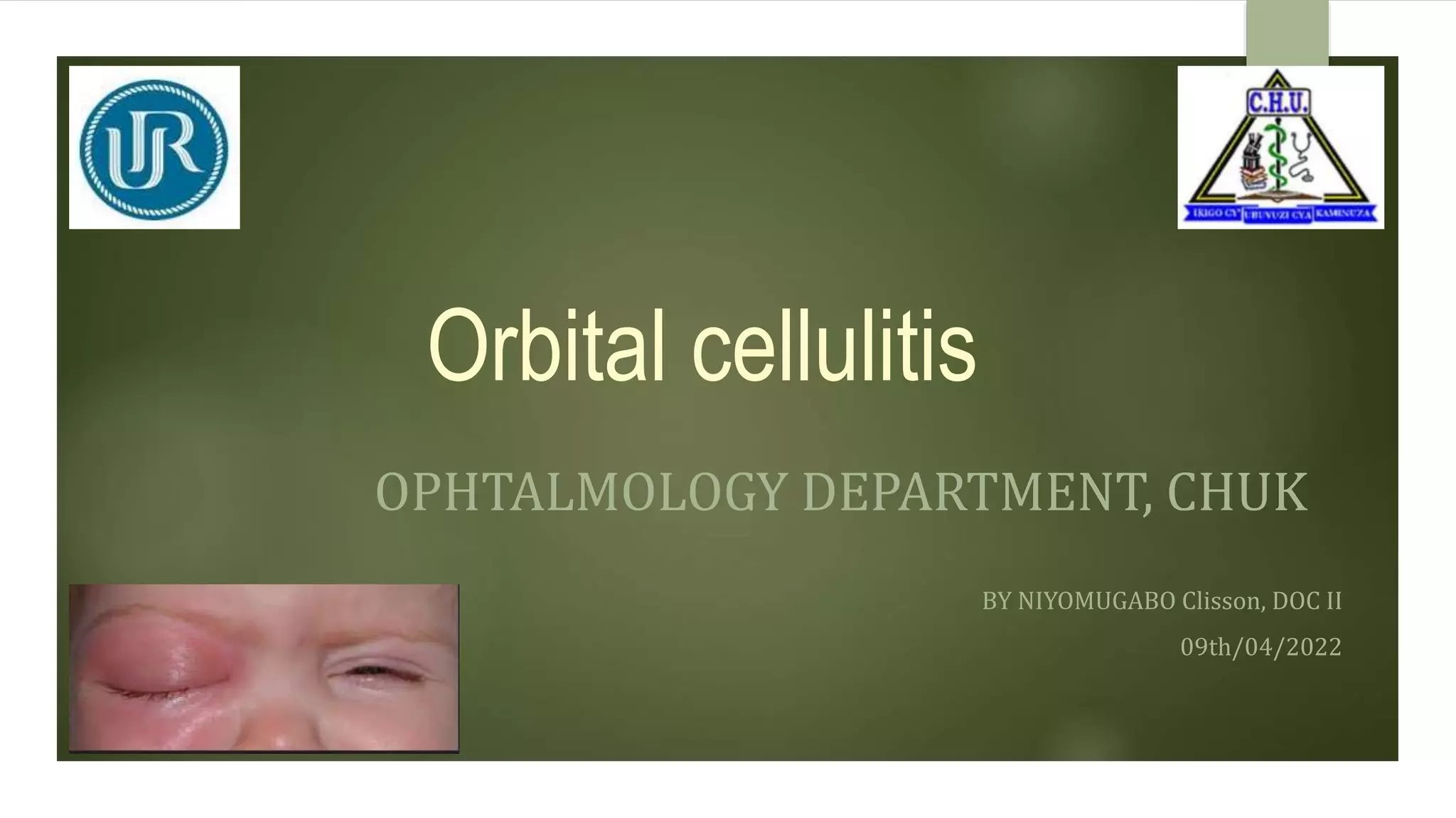 orbital cellulitis.pptx | Ear, Nose and Throat Conditions | Diseases ...